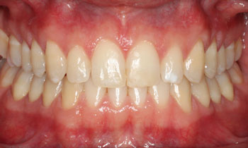 Orthodontics Care using Computer Simulation Technology Gatineau Ottawa ...