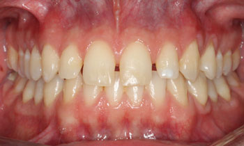 Orthodontics Care using Computer Simulation Technology Gatineau Ottawa ...